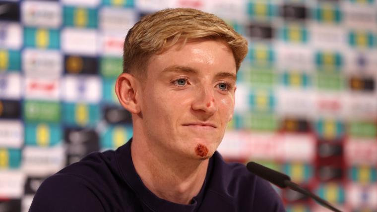 Anthony Gordon Facial Injury: The Strange Reason Why The English Winger ...